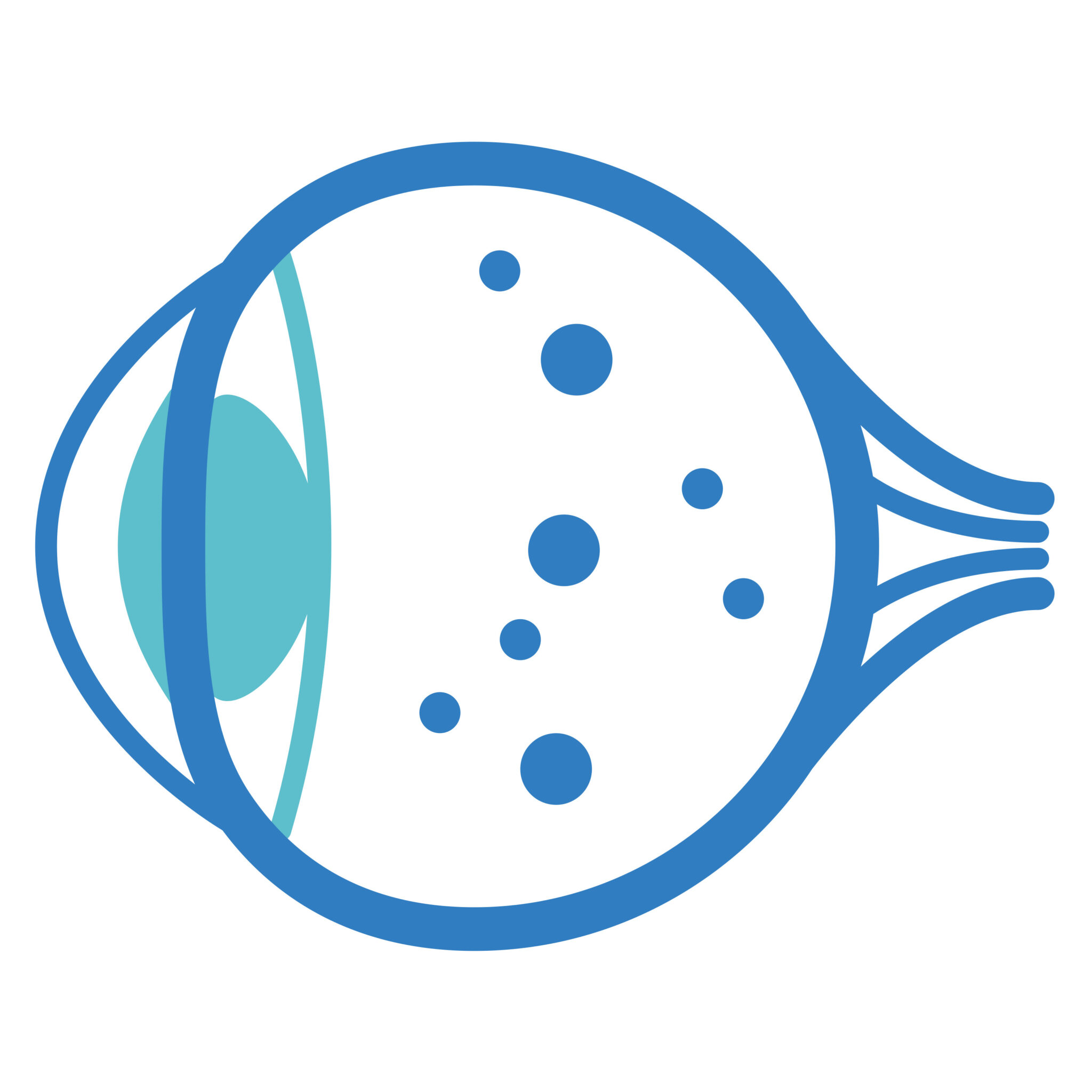 Moscas Flotantes Visuales (Miodesopsias)