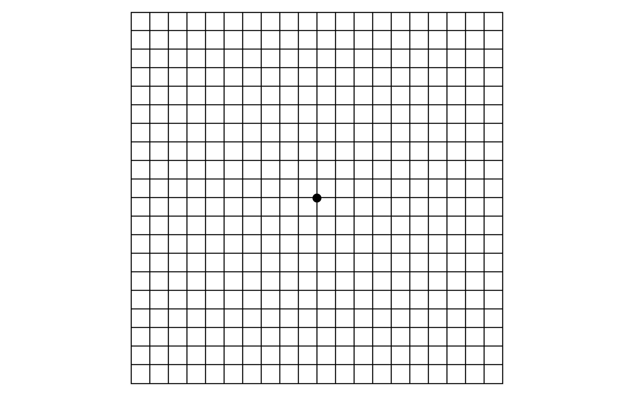 test visual Rejilla de Amsler