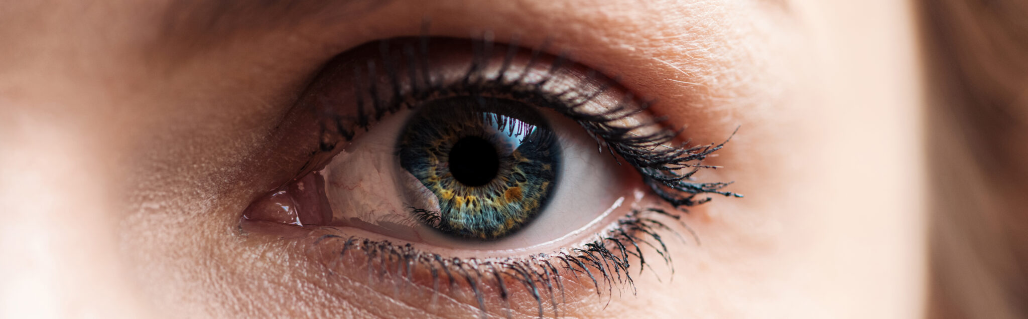 Conoce Las razones por las cuales el ojo puede cambiar de color